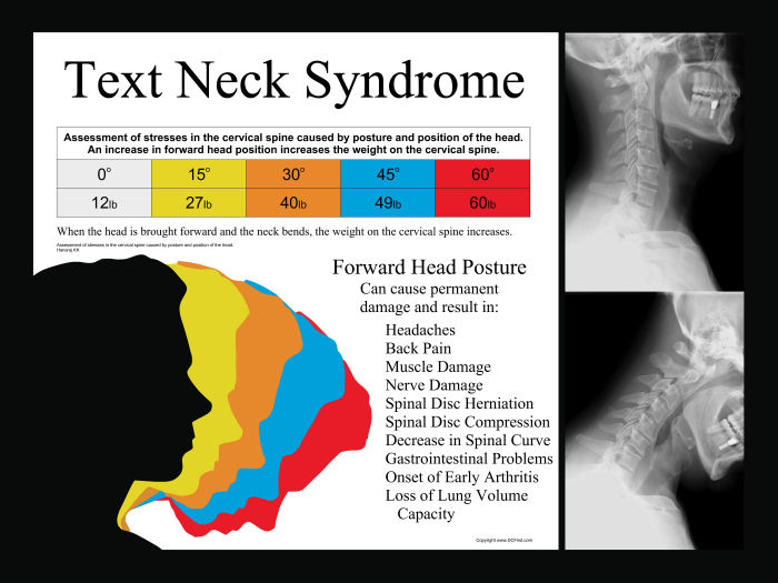 Cervical pain and Cell phones, continued – Ojas Smart PT, DPT, CSCS for ...