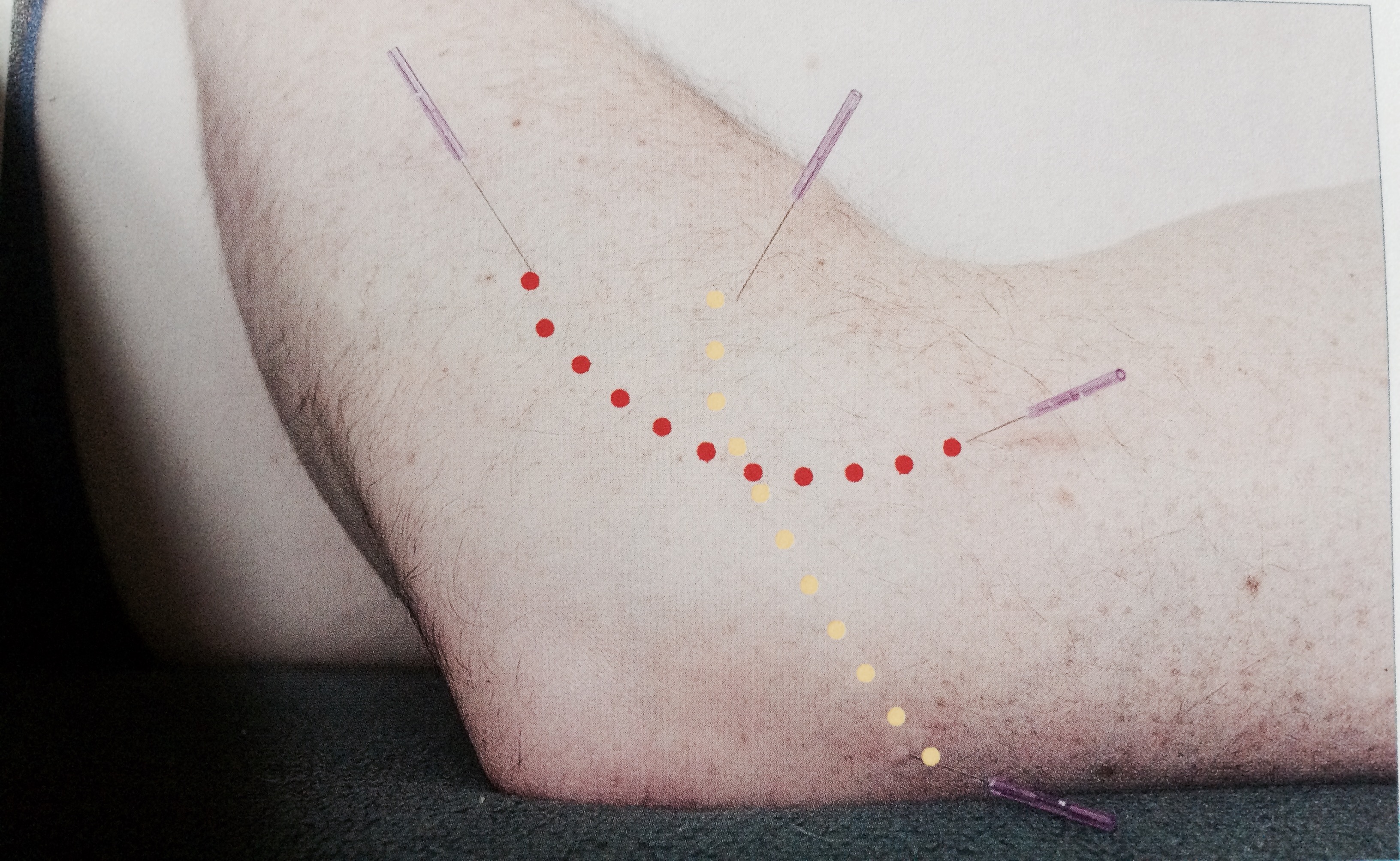 Ojas Smart PT, DPT, CSCS for Team Rehabilitation – Tips on Injury ...